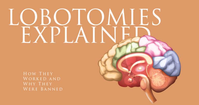 Lobotomies Explained - San Jose Mental Health